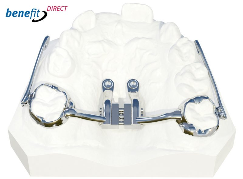 Rapid Maxillary Expansion and Protraction - Ortho Tech Lab